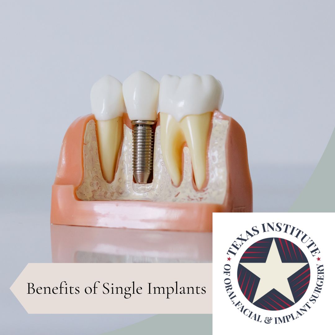 Tooth Loss: Benefits of Single Dental Implant - Texas Institute of Oral ...